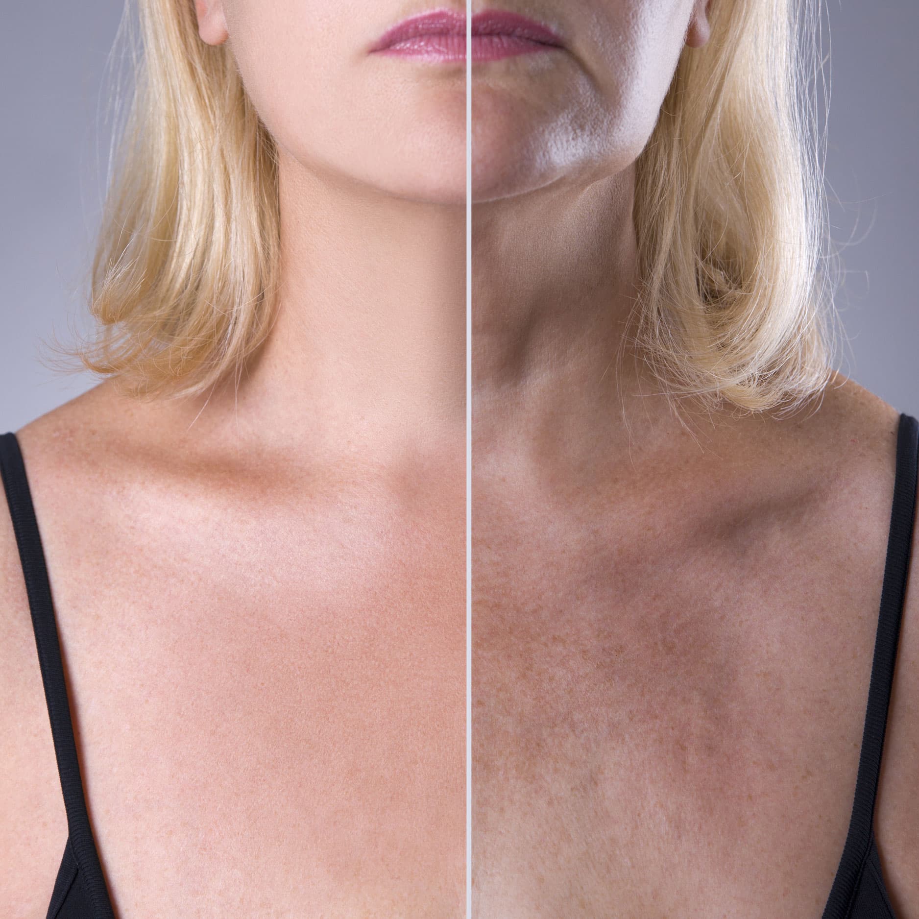 Medicina estética corporal - Clínica Xana